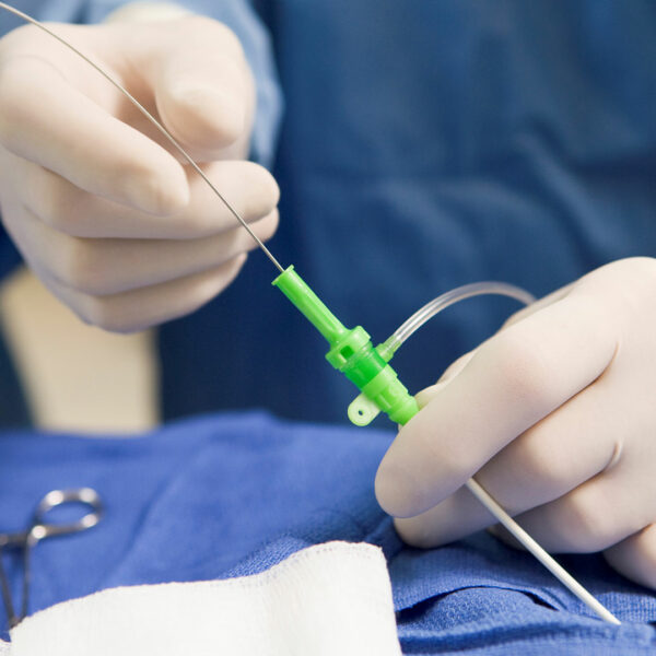 Anjio Nedir? Nasıl yapılır? - Elite Hospital