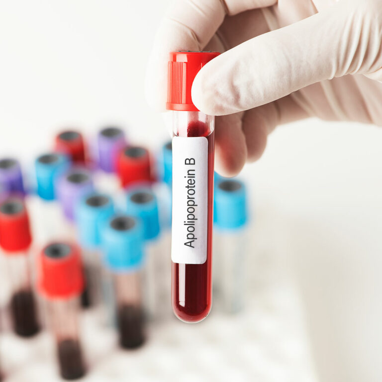 A New Cholesterol Marker in Cardiovascular Health: Apolipoprotein B ...